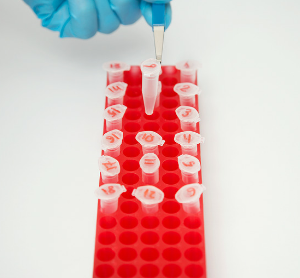 What to Expect at an Allergy Skin Test for a Toddler - About That Mom Life